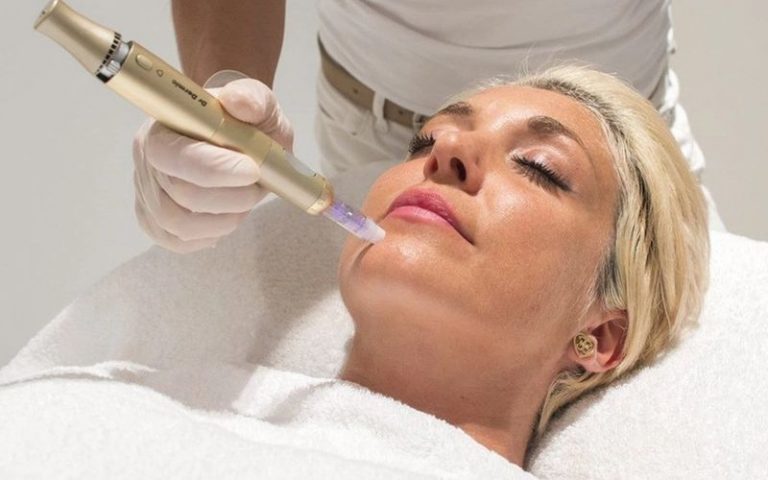 Phi kim trị thâm là gì? Quy trình & Cách chăm sóc sau khi phi kim