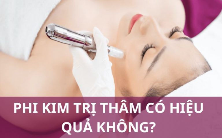 Phi kim trị thâm là gì? Quy trình & Cách chăm sóc sau khi phi kim